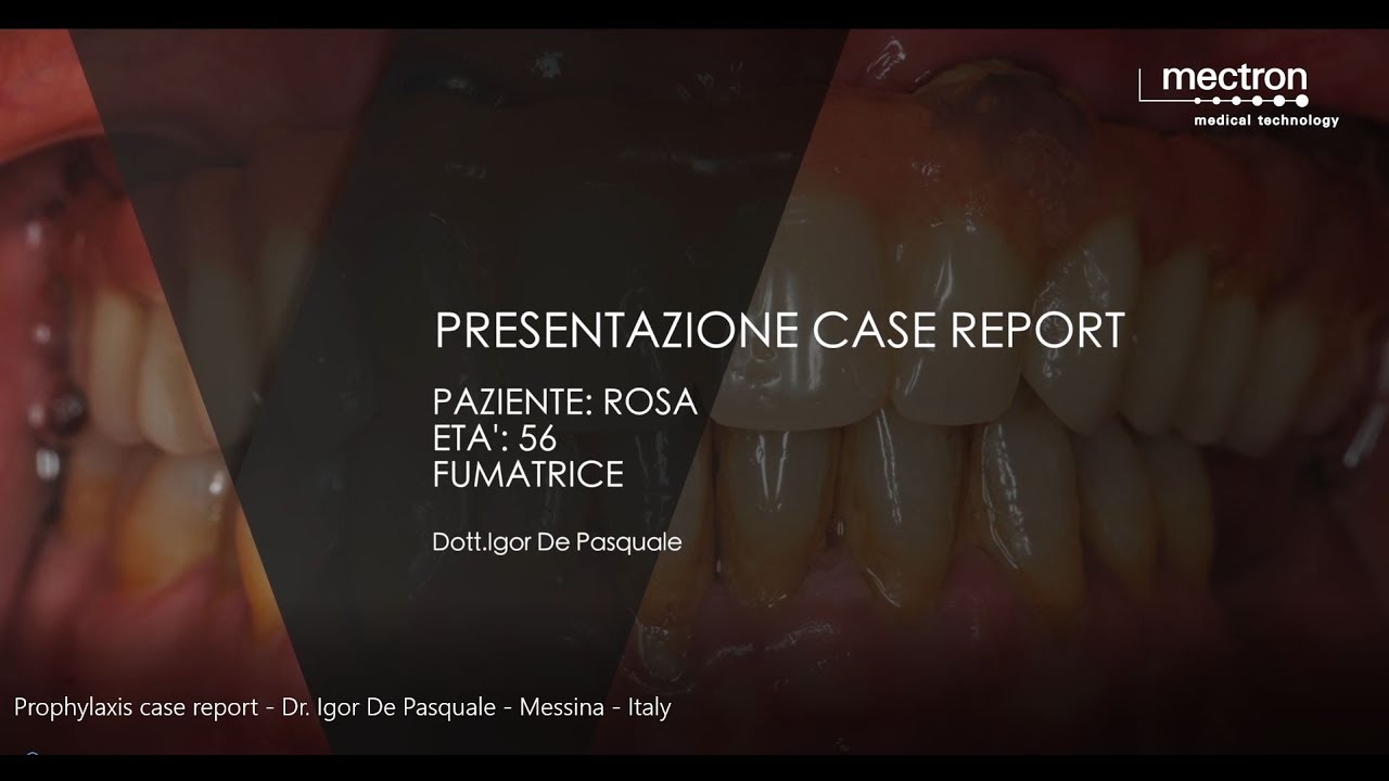 Scopri le le soluzioni per ottimizzare la performance clinica in Igiene & Profilassi - Discover ...